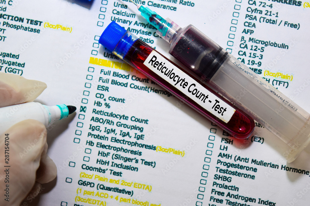 Reticulocyte Count - Test with blood sample. Top view isolated on ...