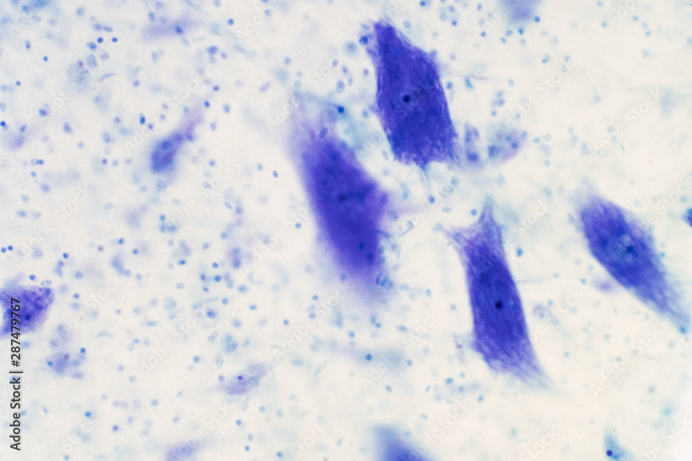 Foto de Stock Neurons and nervous system in the human brain. Histology ...