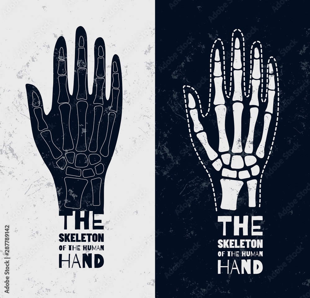 Vector Skeleton Hands. Sign or logo on the medical theme. Vector ...