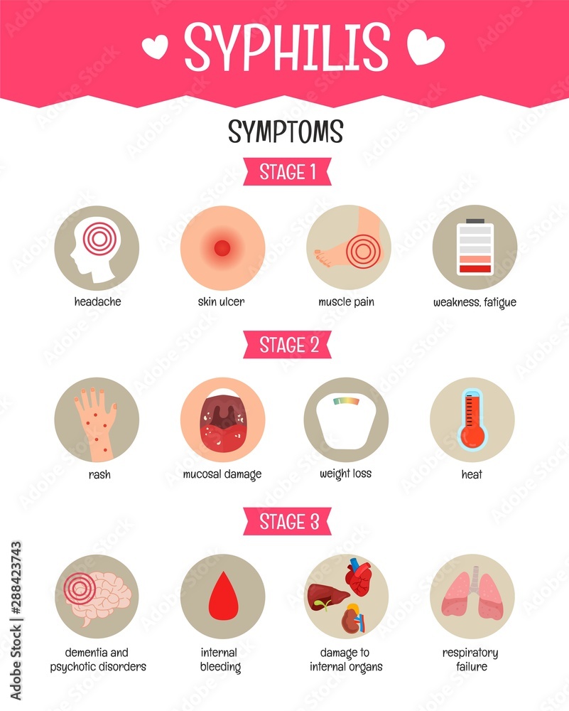 Vector medical poster syphilis. Symptoms of the disease. . Stock Vector ...