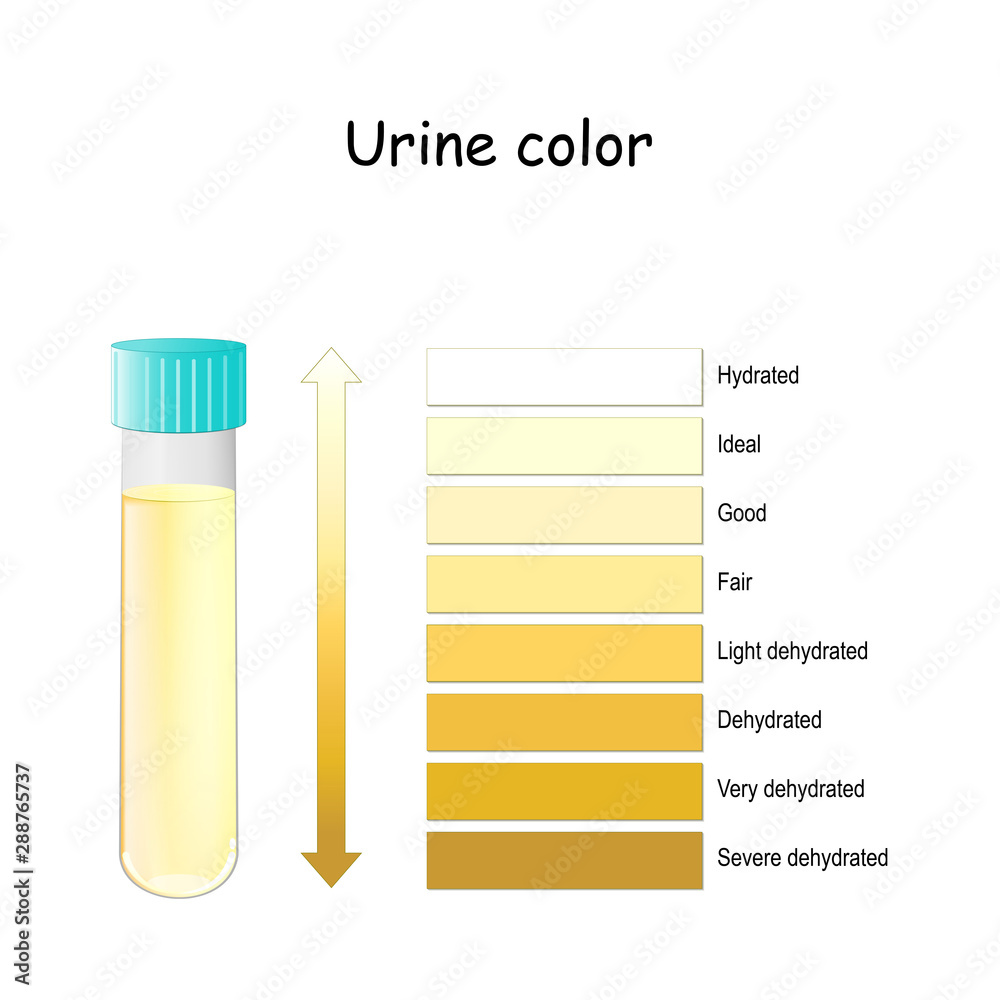 Urine Color. Chart for Assessing hydration and dehydration. Pee Color ...
