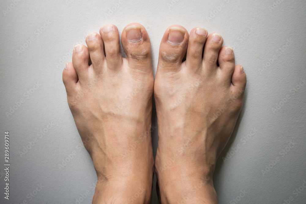 The foot and long nail toes on white concrete background. Stock Photo ...