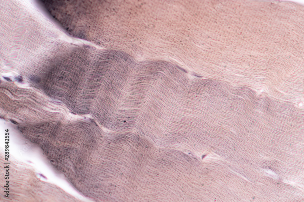 Education anatomy and Histological sample Striated muscle Tissue under ...