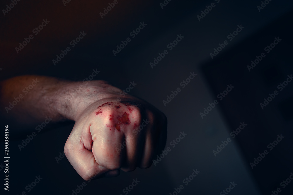 Clenched Left Hand Fist with Bloody and Bruised Knuckles Prepared to ...