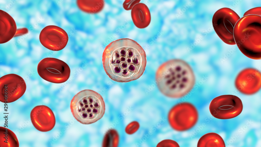 Red blood cells infected with malaria parasite Plasmodium vivax ...