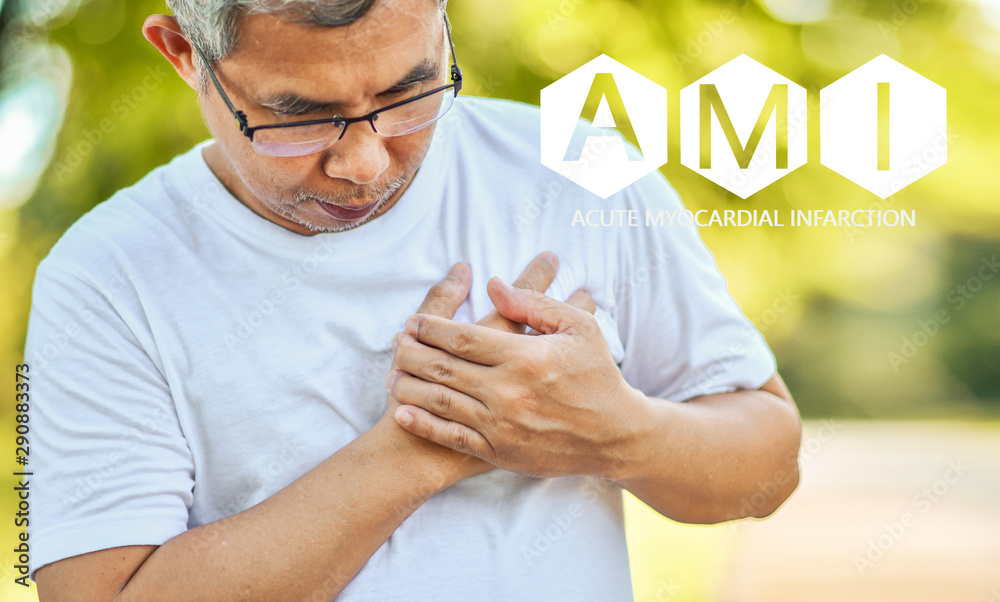 People are sick AMI Acute Myocardial Infarction,STEMI ST Elevated ...