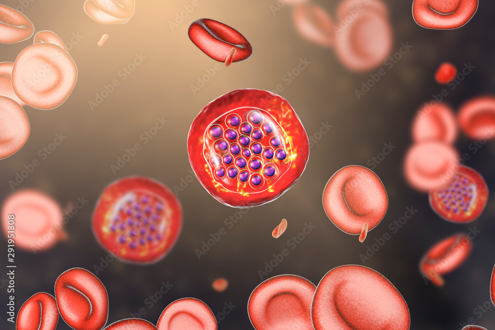 The malaria-infected red blood cells. 3D illustration showing malaria ...