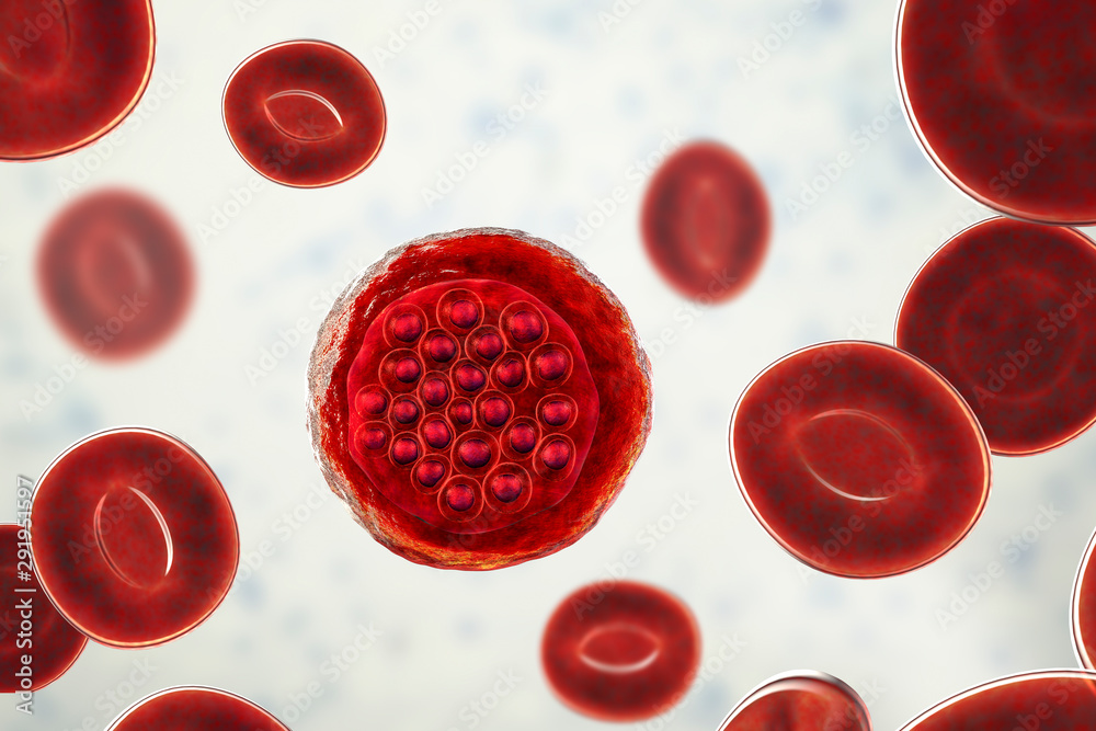 The malaria-infected red blood cells. 3D illustration showing malaria ...