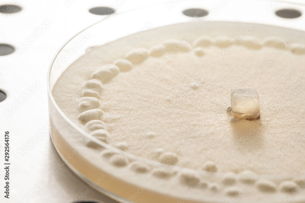 Sample of mold Botrytis cinerea in Petri dish with sclerotia sketches ...