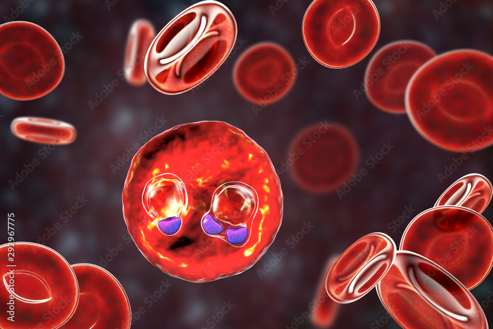 The malaria-infected red blood cells. 3D illustration showing ring-form ...