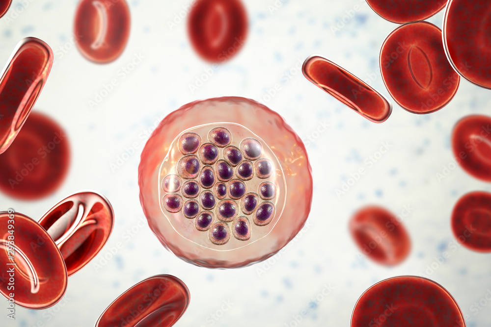 The malaria-infected red blood cells. 3D illustration showing malaria ...