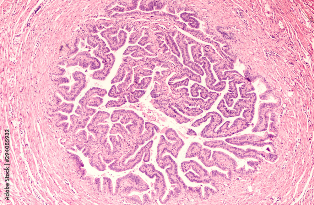 Foto de Stock Family Planning: Cross section of human fallopian tube ...