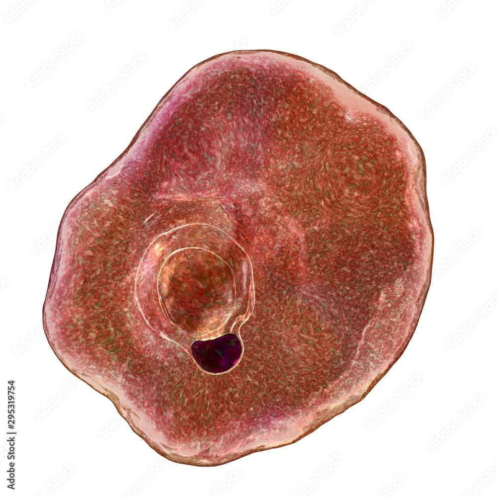 The malaria-infected red blood cell. 3D illustration showing malaria ...