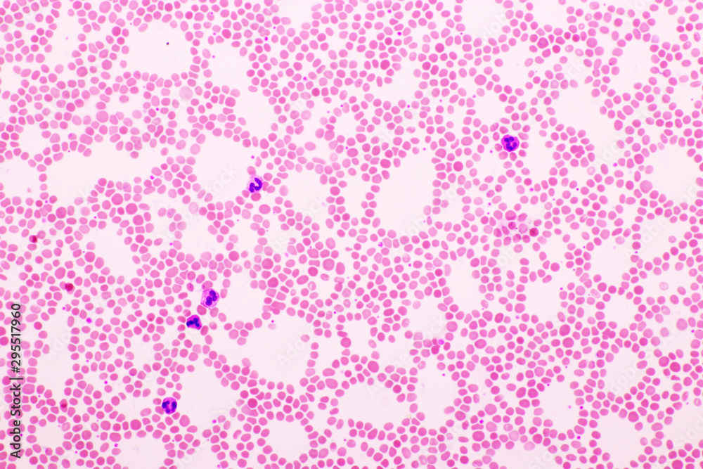 Foto de Stock Picture of white blood cell, red blood cell and platelet ...