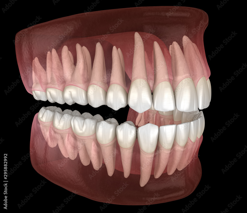 Morphology of mandibular and maxillary human gum and teeth. Medically ...