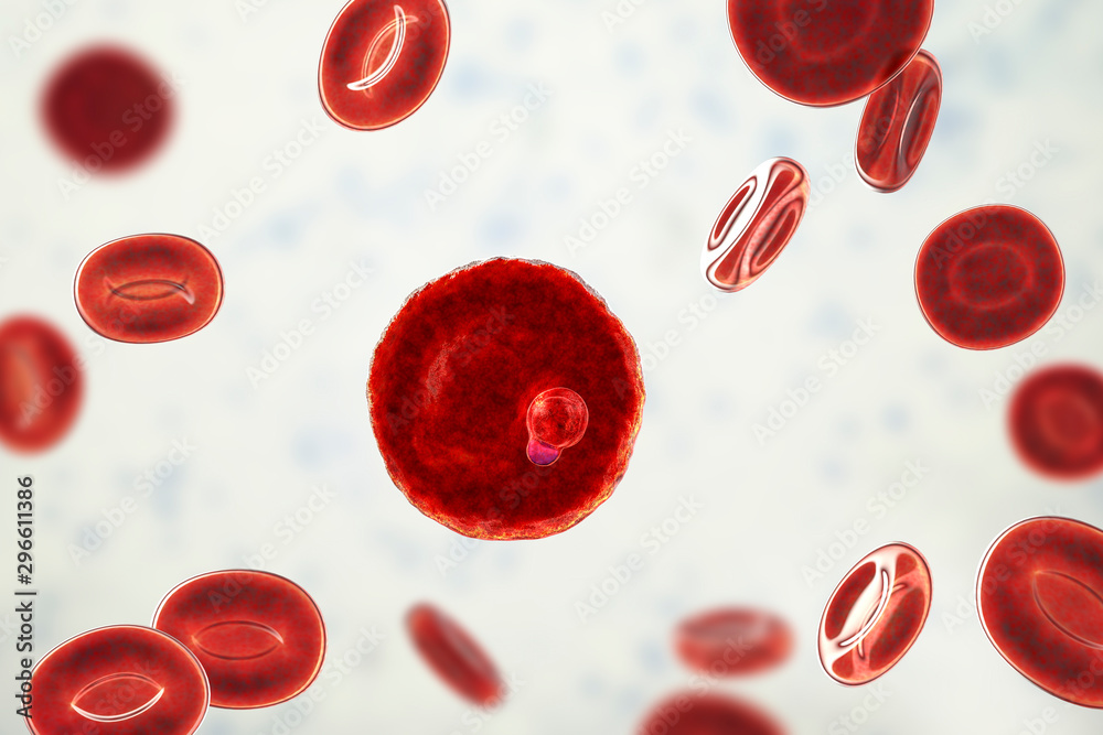The malaria-infected red blood cell. 3D illustration showing parasite ...