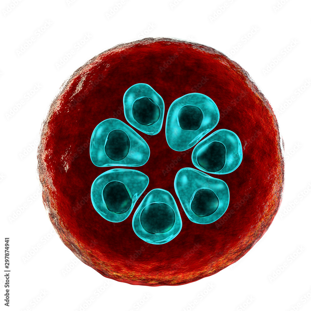The malaria-infected red blood cell. 3D illustration showing parasite ...