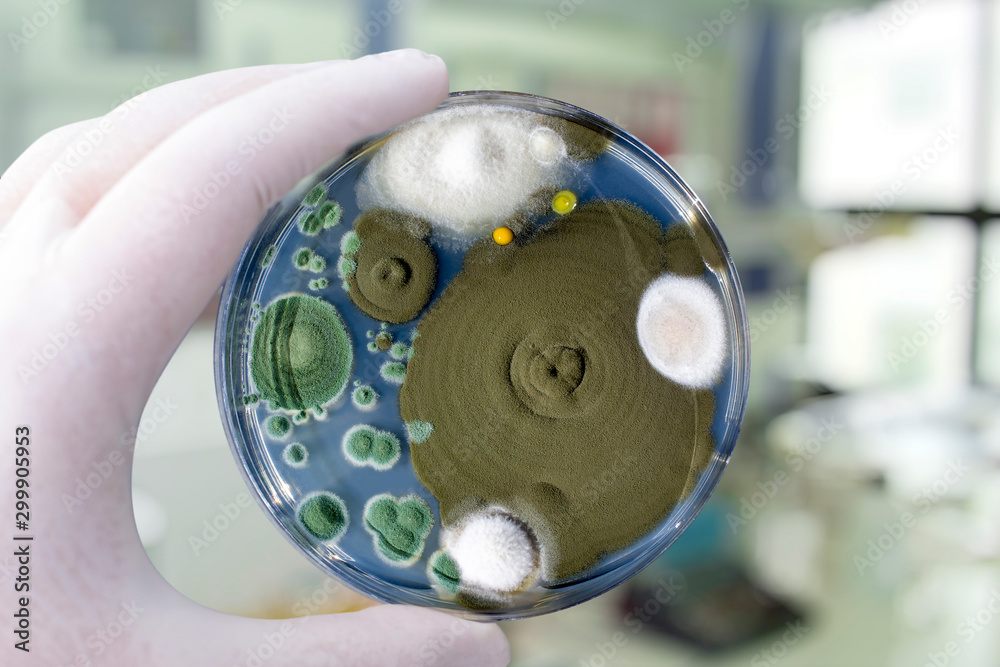 Colonies of different mold fungi grown from indoor air on Petri dish ...