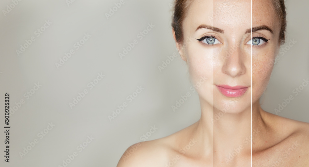 Stages of tanning. Isolated woman on white background. Girls with ...