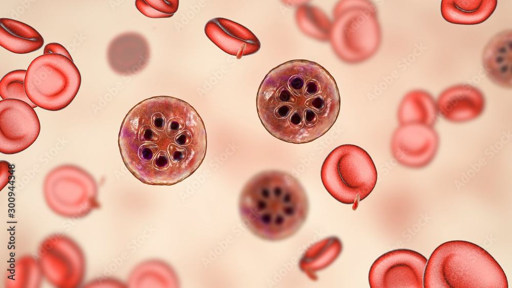 The malaria-infected red blood cell. 3D illustration showing parasite ...