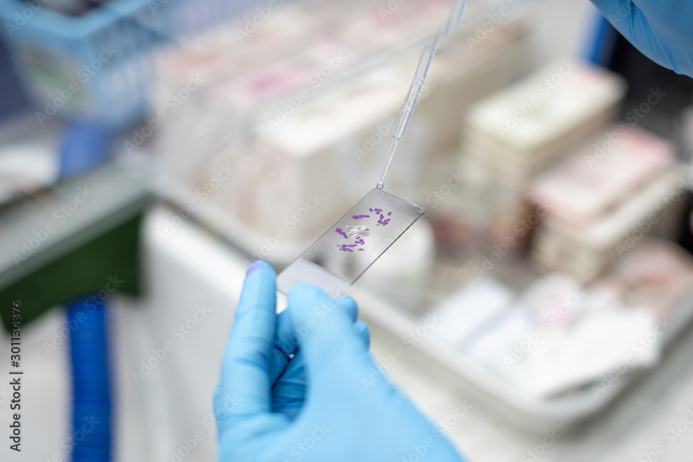 Photo Stock Pathological specimen preparation to detect abnormalities ...