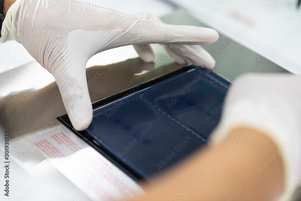 Polymerase Chain Reaction (PCR) and Agarose gel electrophoresis is a ...