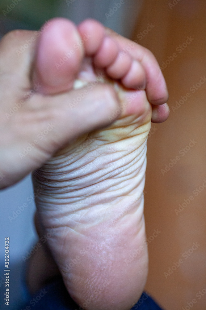 young girl's toes are healthy and beautiful. Stock Photo | Adobe Stock