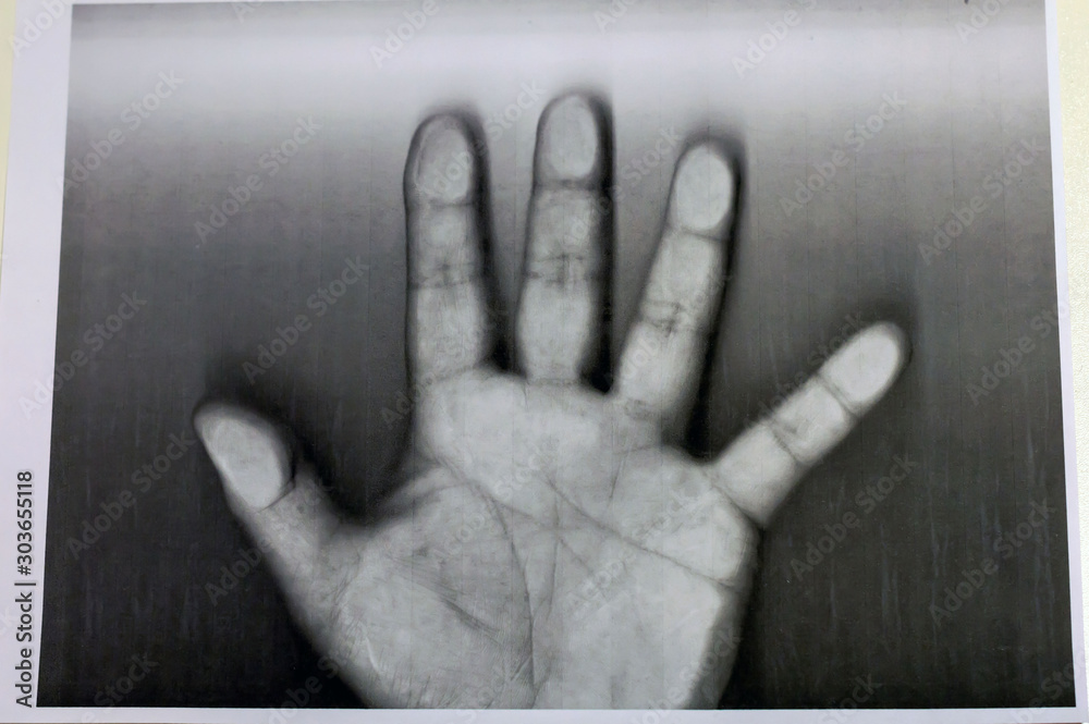 Photocopy of the palm of the hand 5 fingers. Stock Photo | Adobe Stock