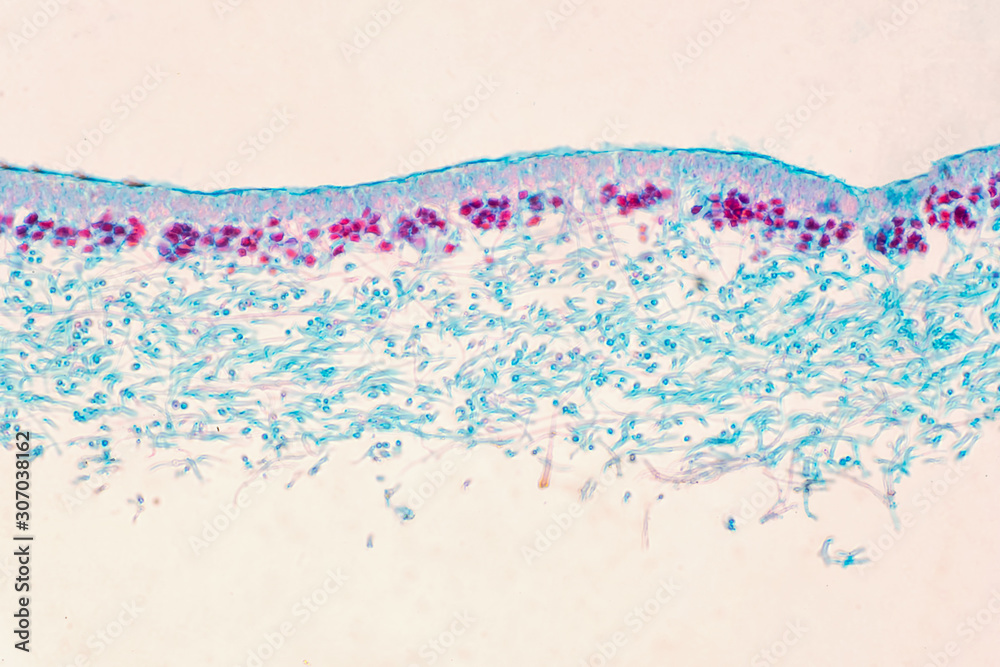 lichen microscope slide