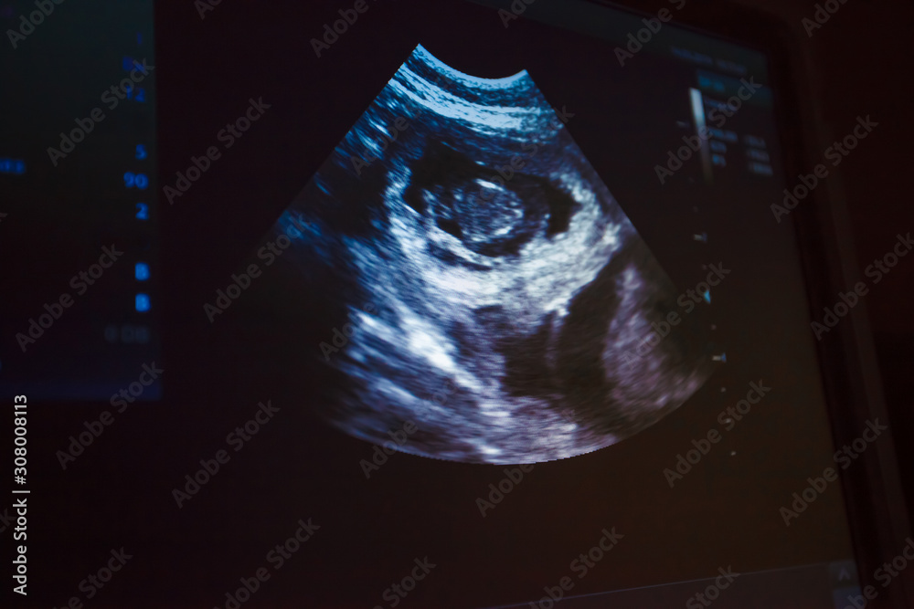 Snapshot of the dog's pregnancy on the monitor screen. Veterinary ...
