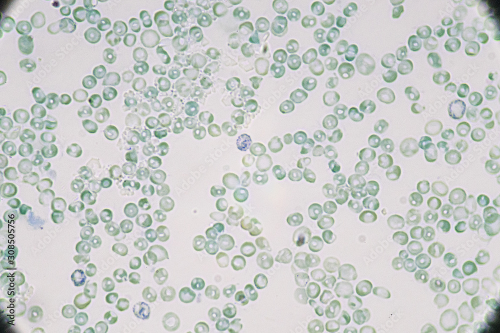 Red blood cells (Polychromasia) Stock Photo | Adobe Stock