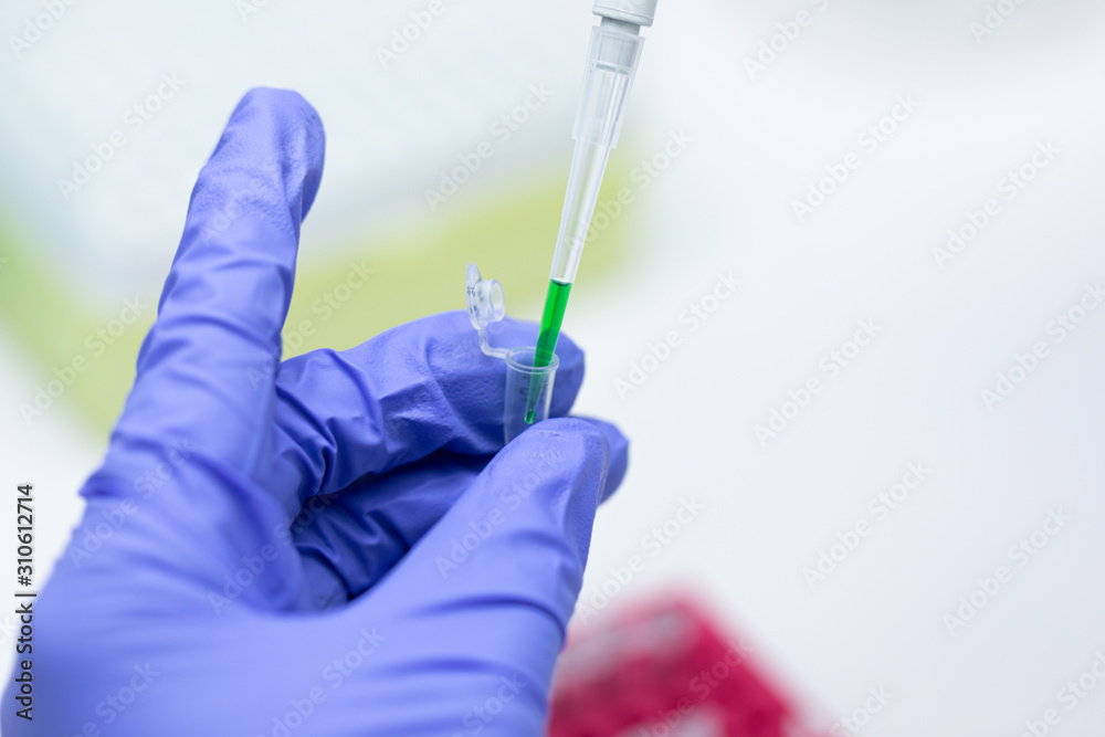 Polymerase Chain Reaction (PCR) and Agarose gel electrophoresis is a ...