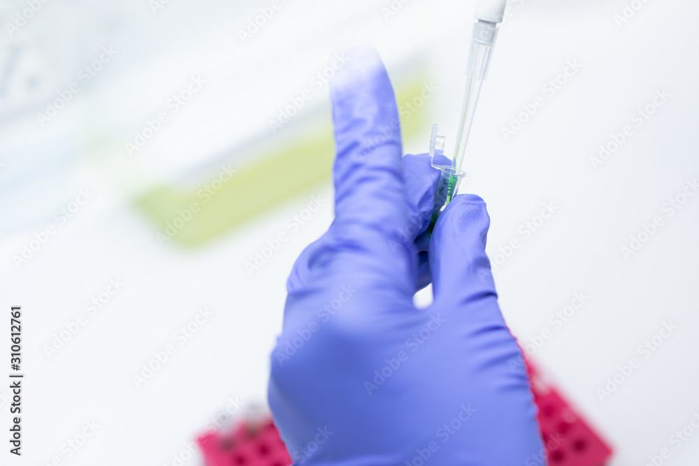 Polymerase Chain Reaction (PCR) and Agarose gel electrophoresis is a ...
