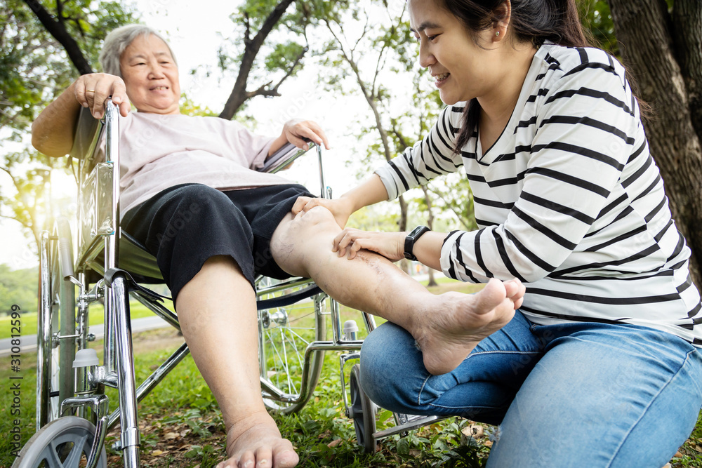 Foto de Stock Asian senior mother in wheelchair,receiving a leg massage from her daughter,old ...