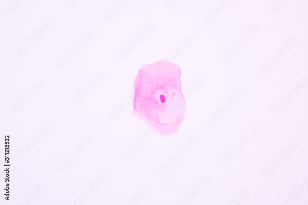 View in microscopic of normal human cervix cells.Squamous epithelium ...