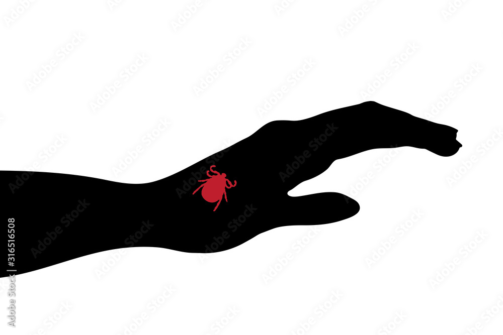 เวกเตอร์ Stock Vector silhouette of tick sitting on human hand on white ...