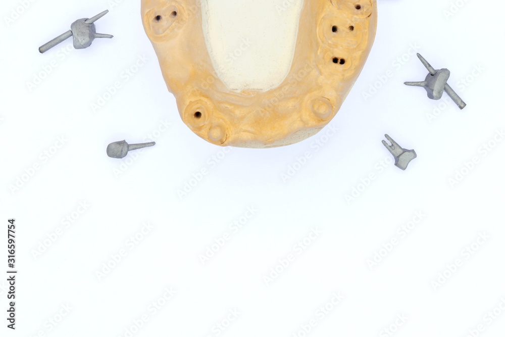 dental metal pins. cast pins with a plaster model of the jaw isolated ...