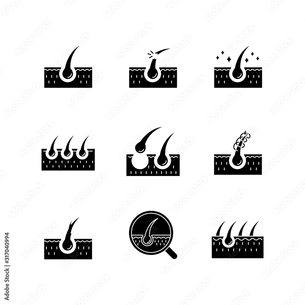 Hair loss black glyph icons set on white space. Damaged hair, unhealthy ...