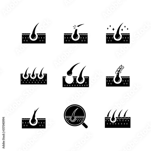 Hair loss black glyph icons set on white space. Damaged hair, unhealthy ...
