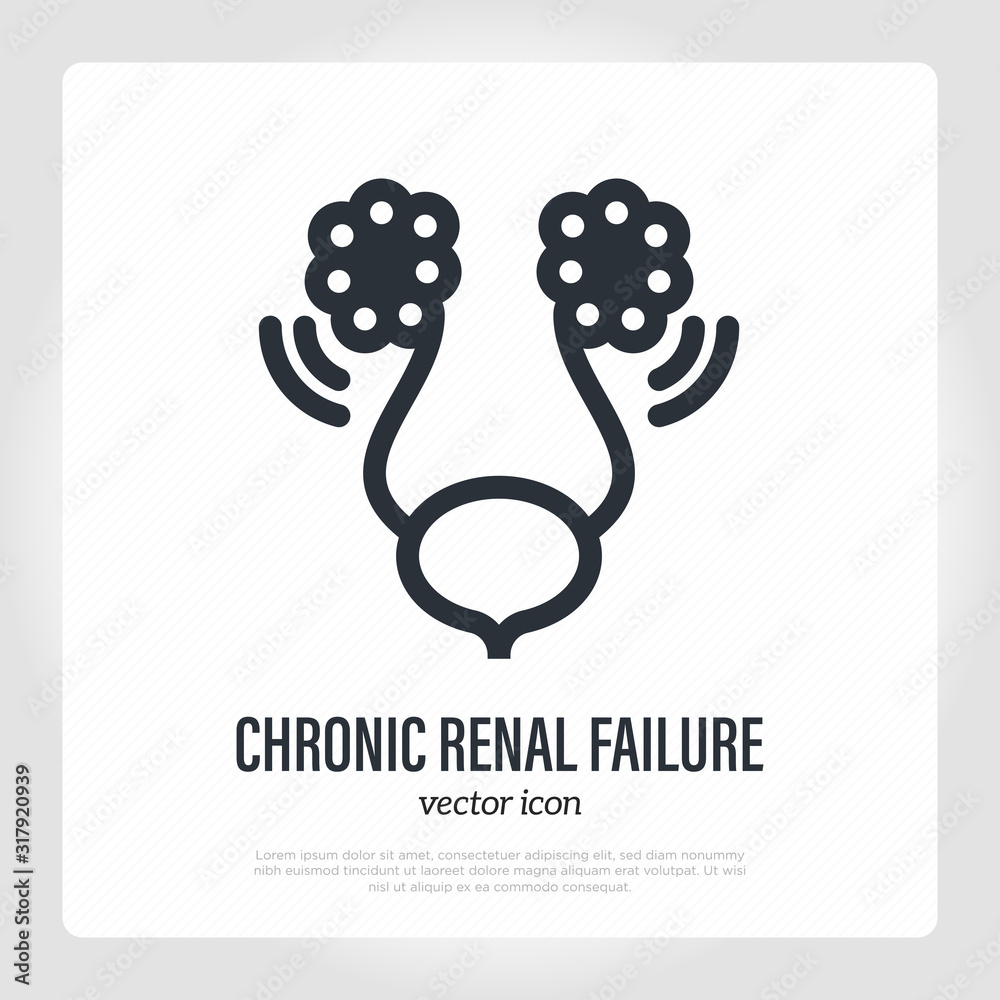 Chronic failure renal. Kidney disease. Pyelonephritis. Thin line icon ...