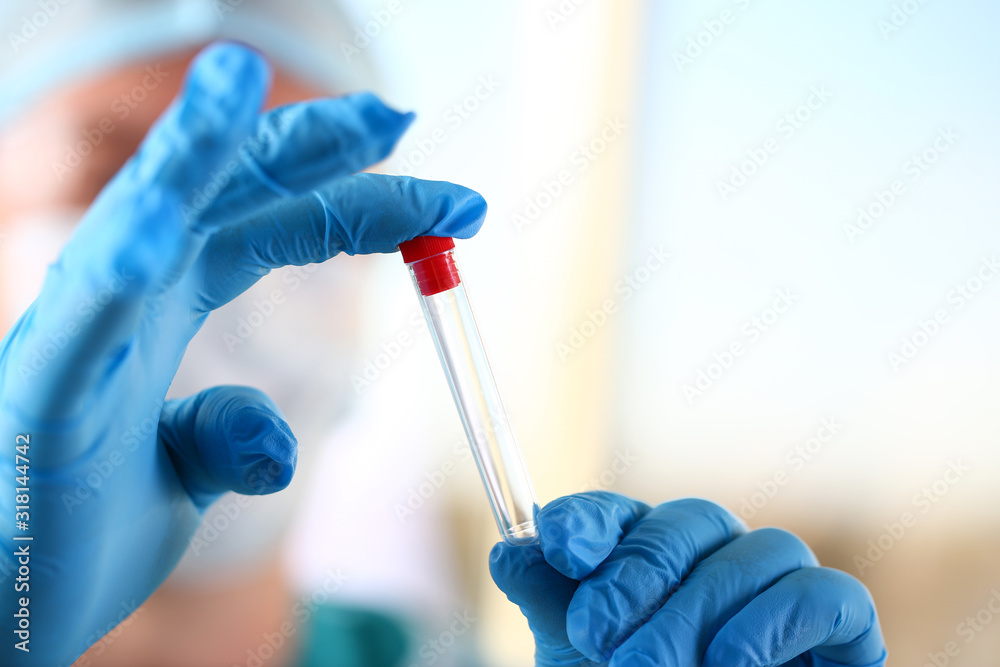 Male scientist hold in arm empty vials closeup. Chemical lab exam food ...