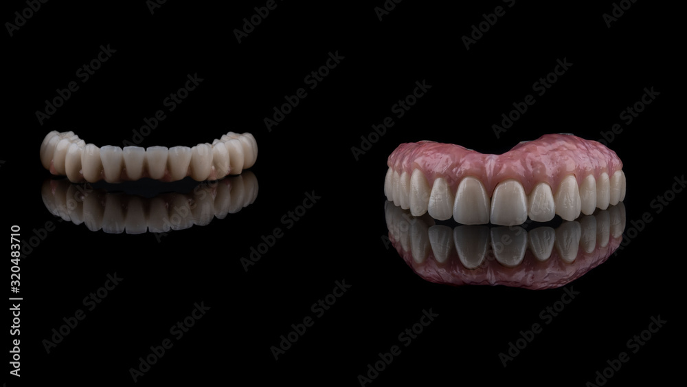 dental implants on a black background Stock Illustration | Adobe Stock