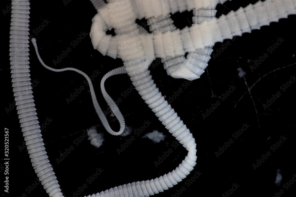 The study of Tapeworm infection is caused by ingesting food or water ...