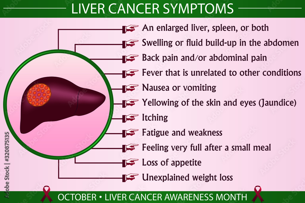 Liver cancer symptoms infographic vector illustration. Health ...