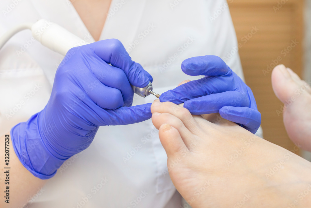 Therapeutic pedicure. Master podologist does hardware pedicure. visit ...