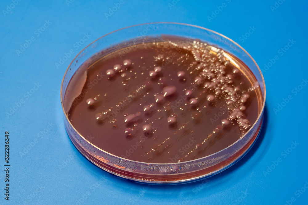 bacterial colonies on agar medium petri dish plate plate on MacConkey ...