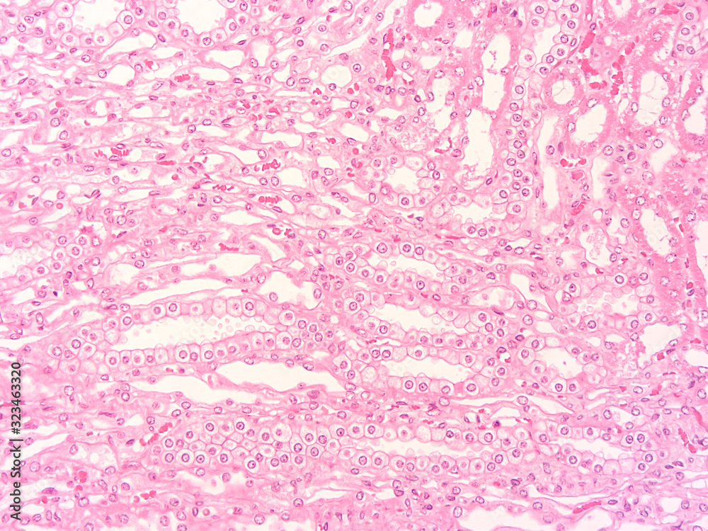 picture of histology human tissue with microscope from laboratory (not ...