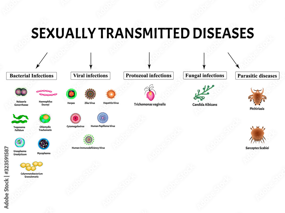 Vector de Stock HIV, herpes, papilloma, hepatitis, cytomegalovirus ...