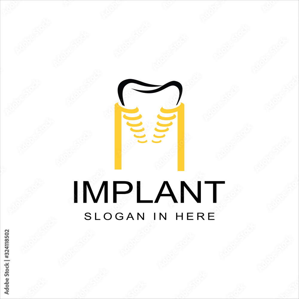 dental implant logo vector icon illustration Stock Vector | Adobe Stock