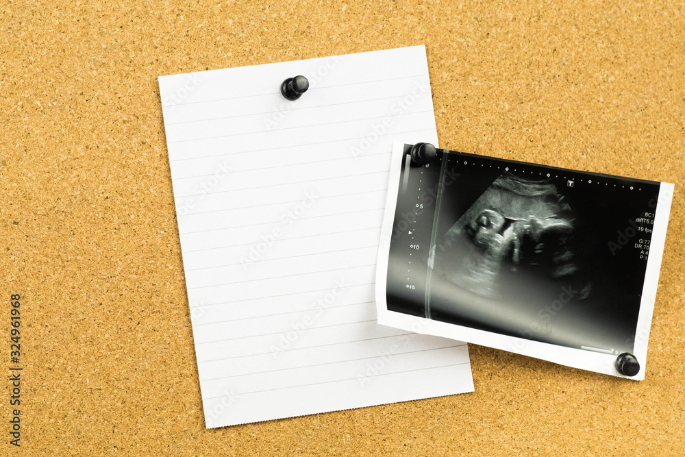 blank note on a cork card board with an ultrasound photo of baby fetus ...